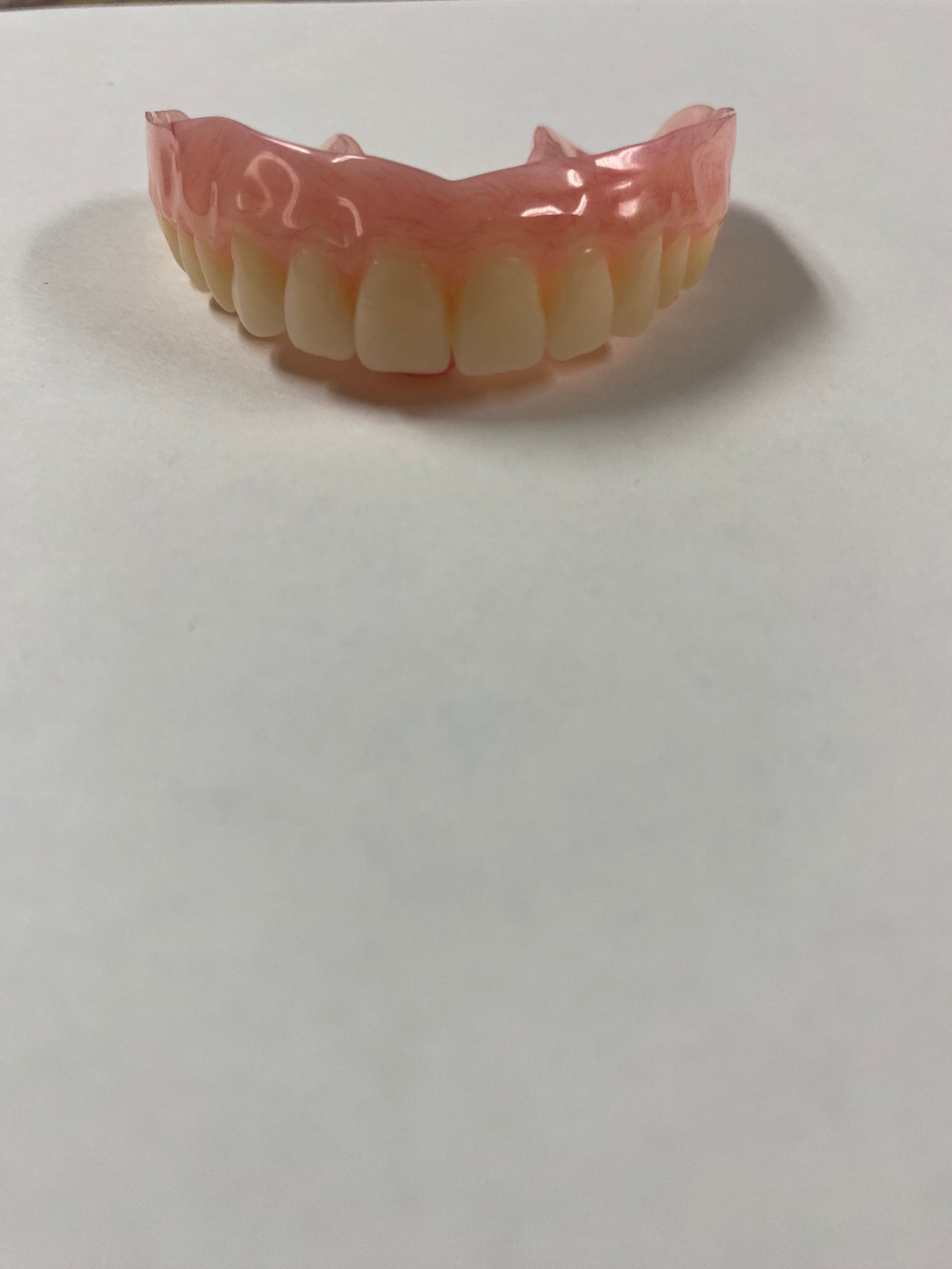 U-Shape Upper Denture – Saldentures