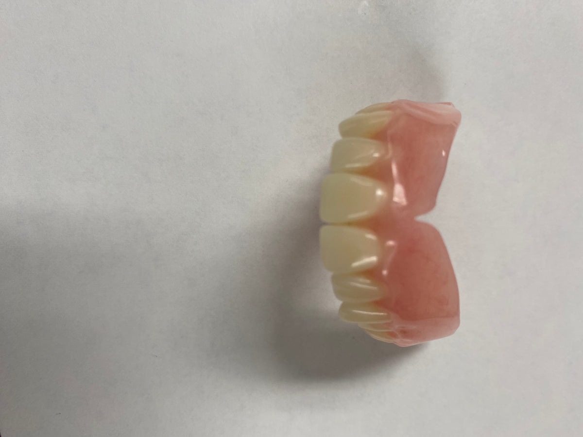 U-Shape Horseshoe Denture – Saldentures