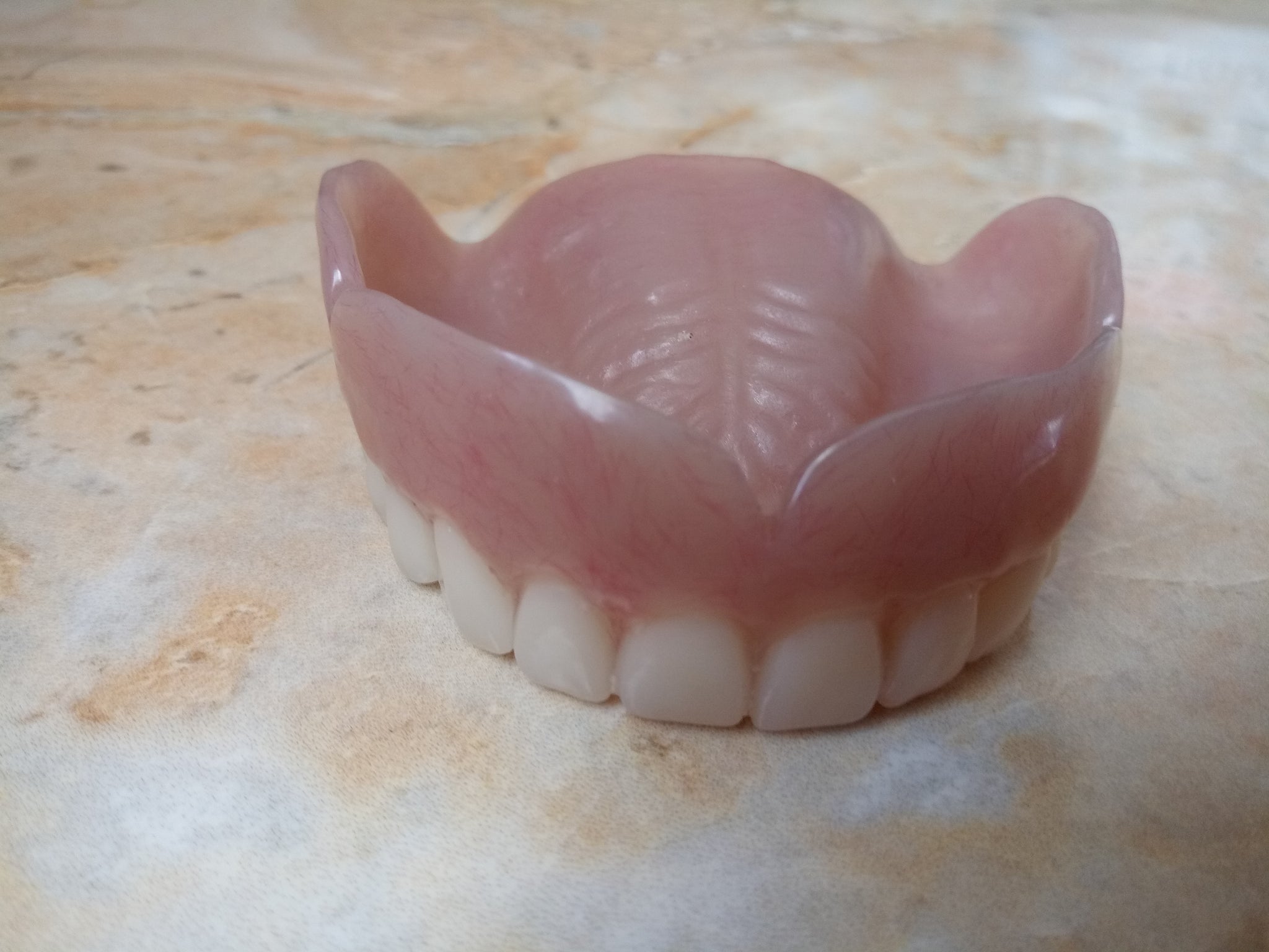 Full Upper U-Shape Denture – Saldentures