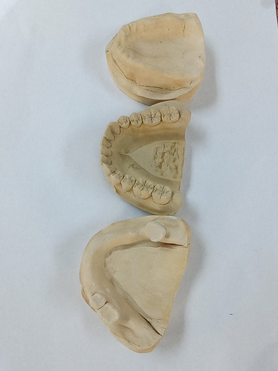 DIY Denture Models, Upper And Lower Lab Stone mold cast/plaster Mold ...