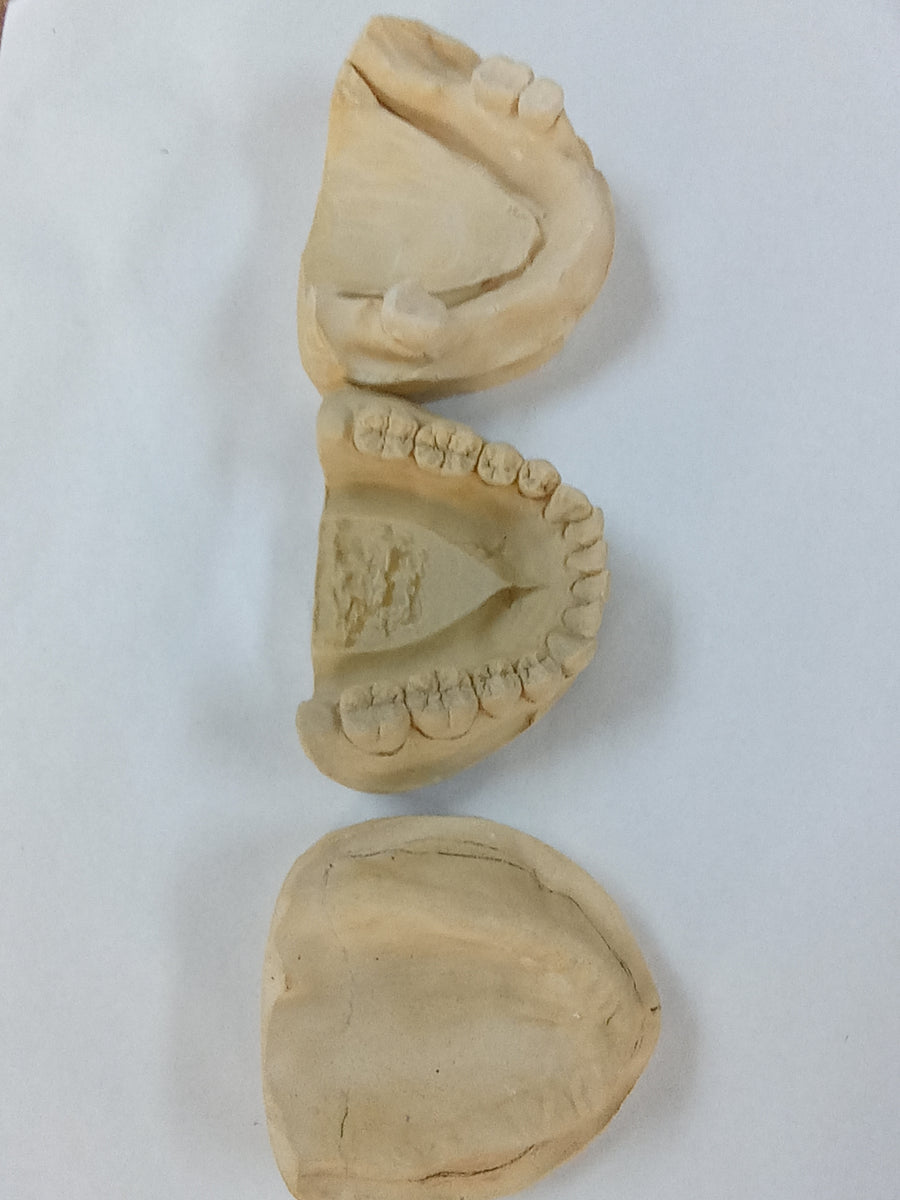 DIY Denture Models, Upper And Lower Lab Stone mold cast/plaster Mold ...