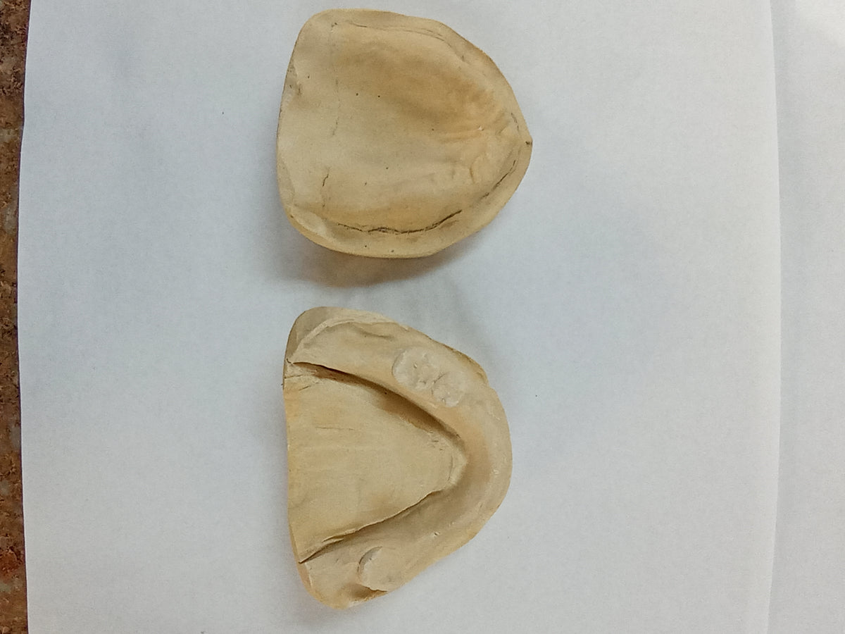 DIY Denture Models, Upper And Lower Lab Stone mold cast/plaster Mold ...