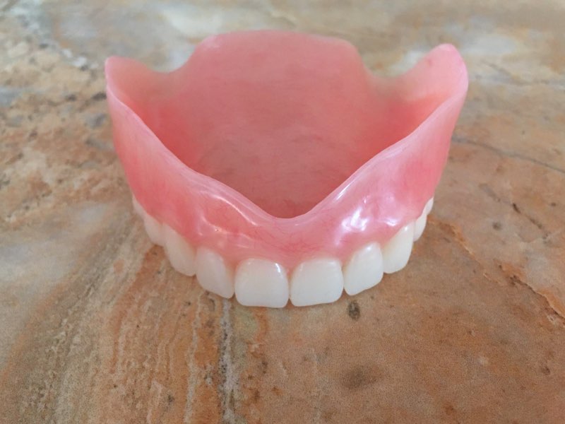 Full Upper U-Shape Denture – Saldentures