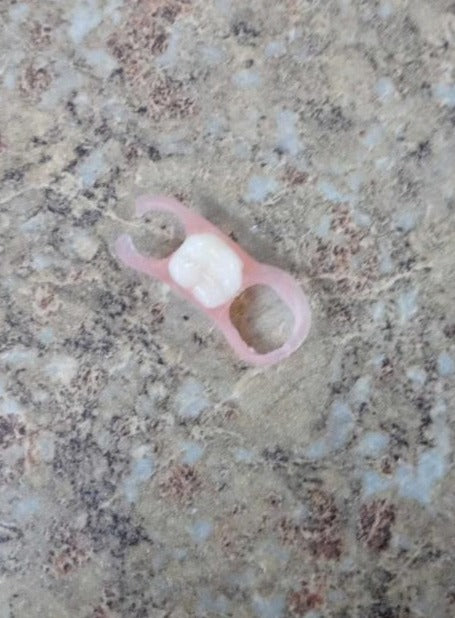 Flexible Custom Nesbit Denture – Saldentures