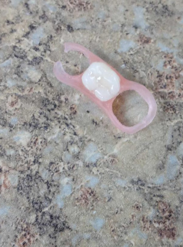 Flexible Custom Nesbit Denture – Saldentures