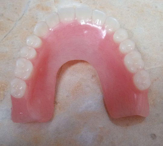 Full Upper U-Shape Denture – Saldentures