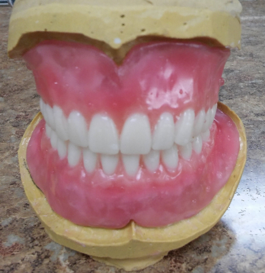 Upper and Lower Denture Custom Made Acrylic False Teeth Denture ...