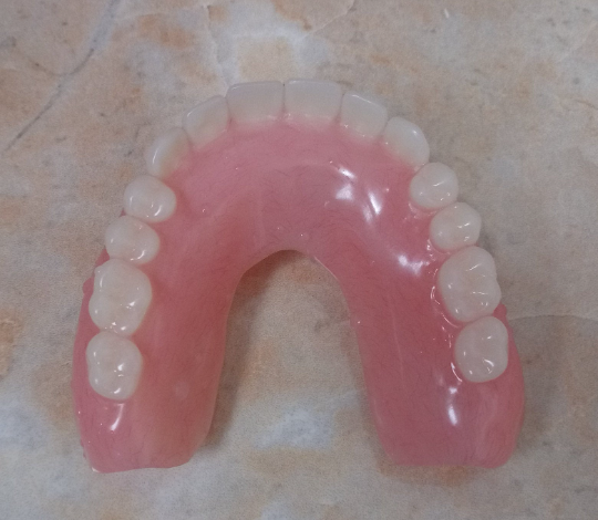 Medium, Full U-Shape Upper Denture – Saldentures