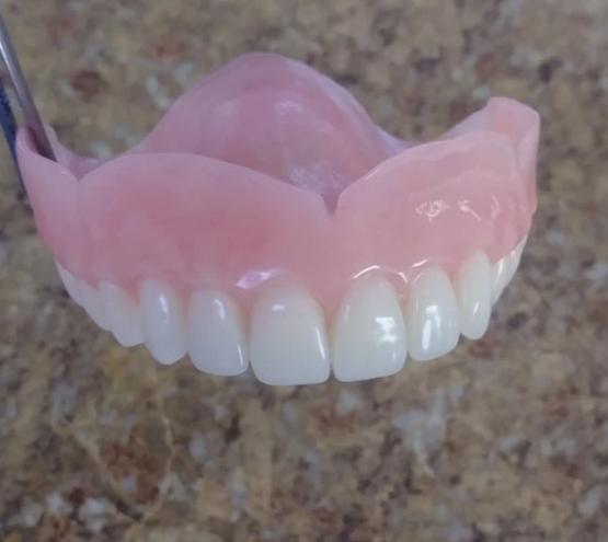 Big Upper False Teeth Acrylic Denture – Saldentures