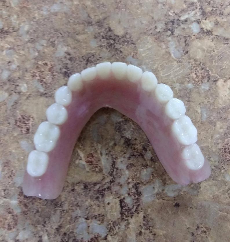 Big Fullset Dark Acrylic Upper and Lower Denture – Saldentures