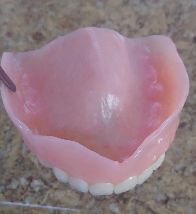 Big Upper False Teeth Acrylic Denture – Saldentures